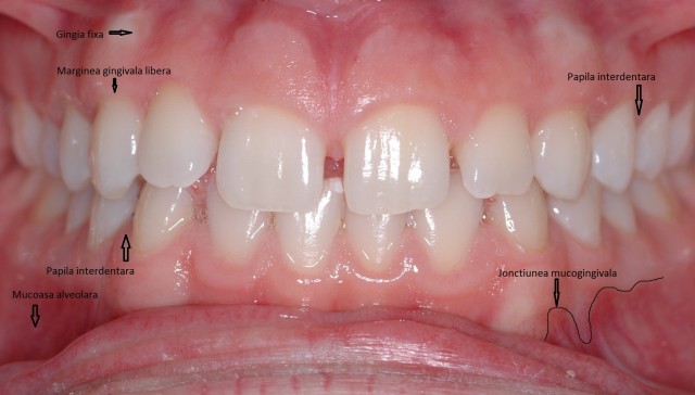 Noţiuni de anatomie gingivo-parodontală | Chirurgie Orala